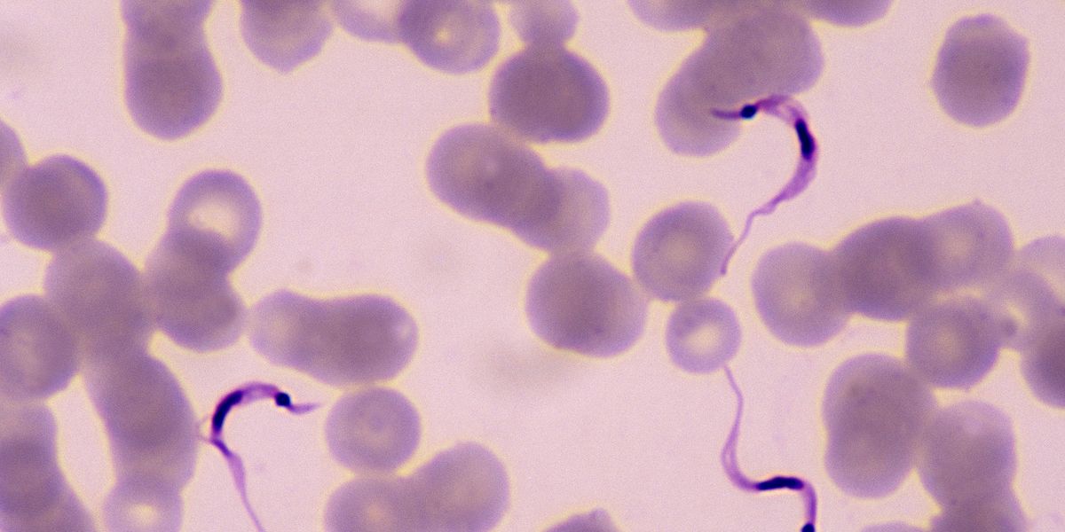 Dangerous ‘Kissing Bug’ Illness Chagas Has Expanded to These 32 States ...