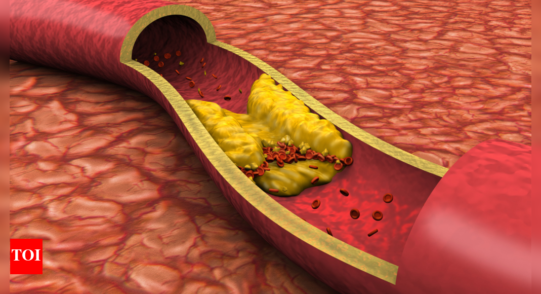Four common beverages that may reduce artery plaque and enhance blood ...