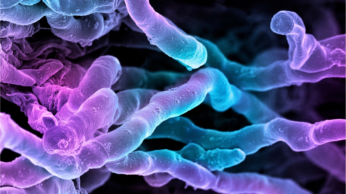 Strong New Antibiotic Was ‘Right in Front of Us’ for Years – Total News