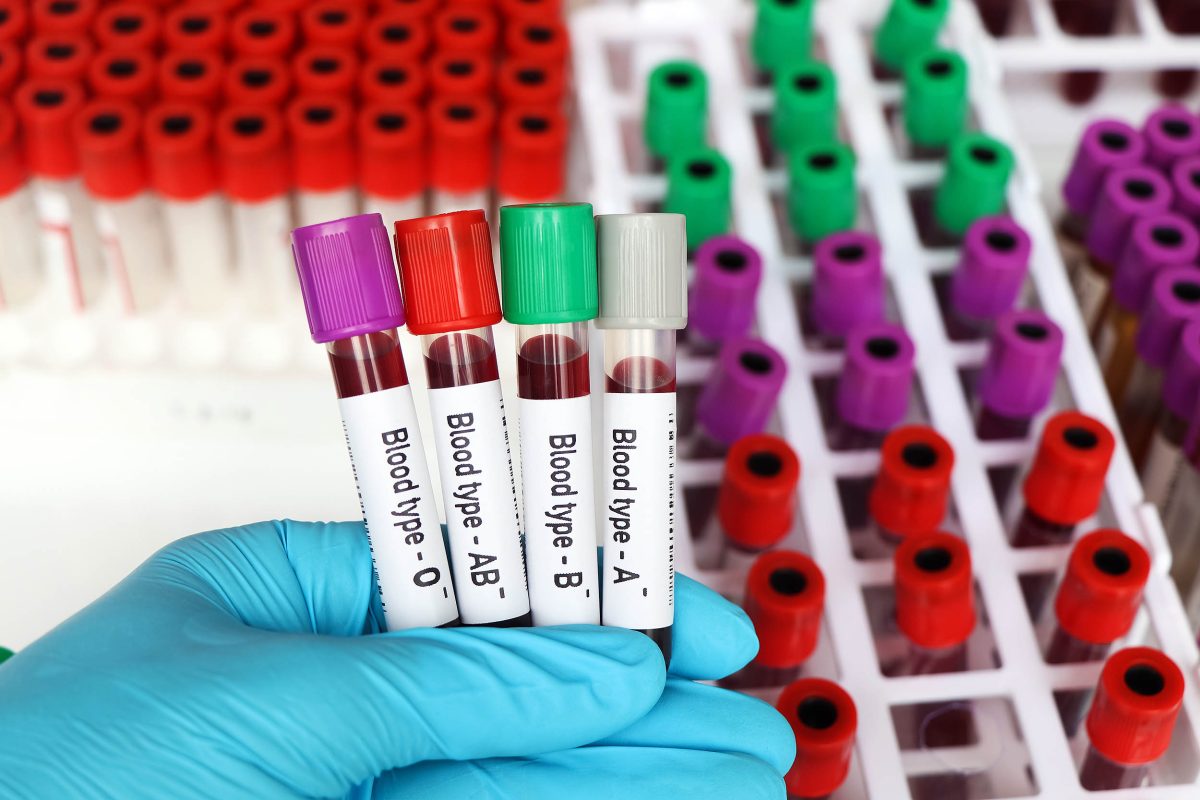 Unexpected connection discovered between blood type and stroke risk ...