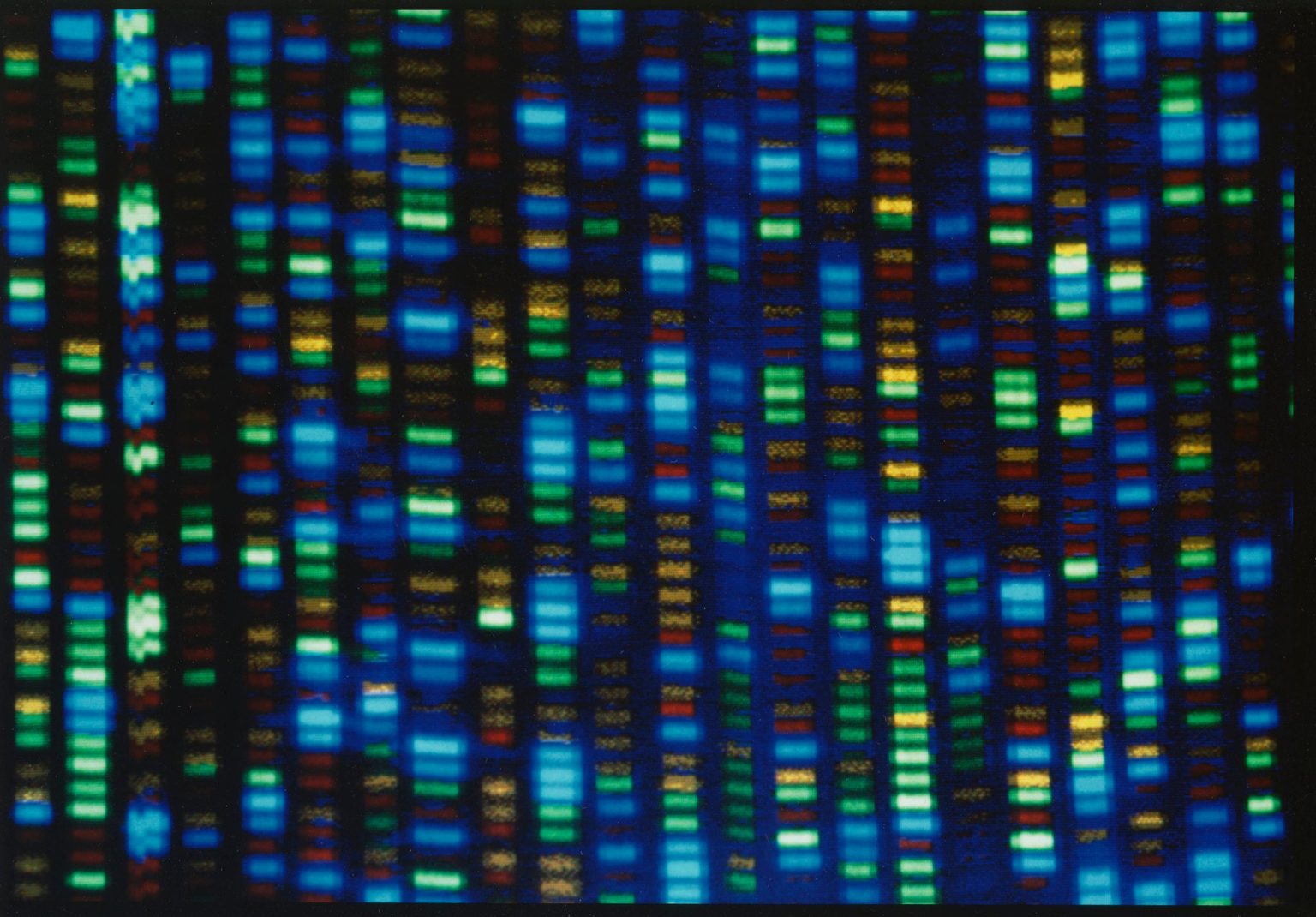 It has to be genetics: Study reveals that genes are essential for human ...